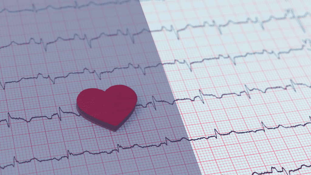 Heart Rate Monitoring: Best Practices for Accurate Data - KORR Medical ...